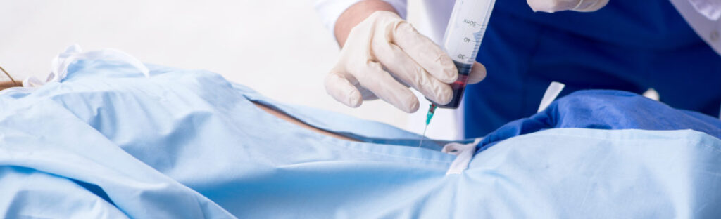 Stellate ganglion block injection – Total Pain Clinic